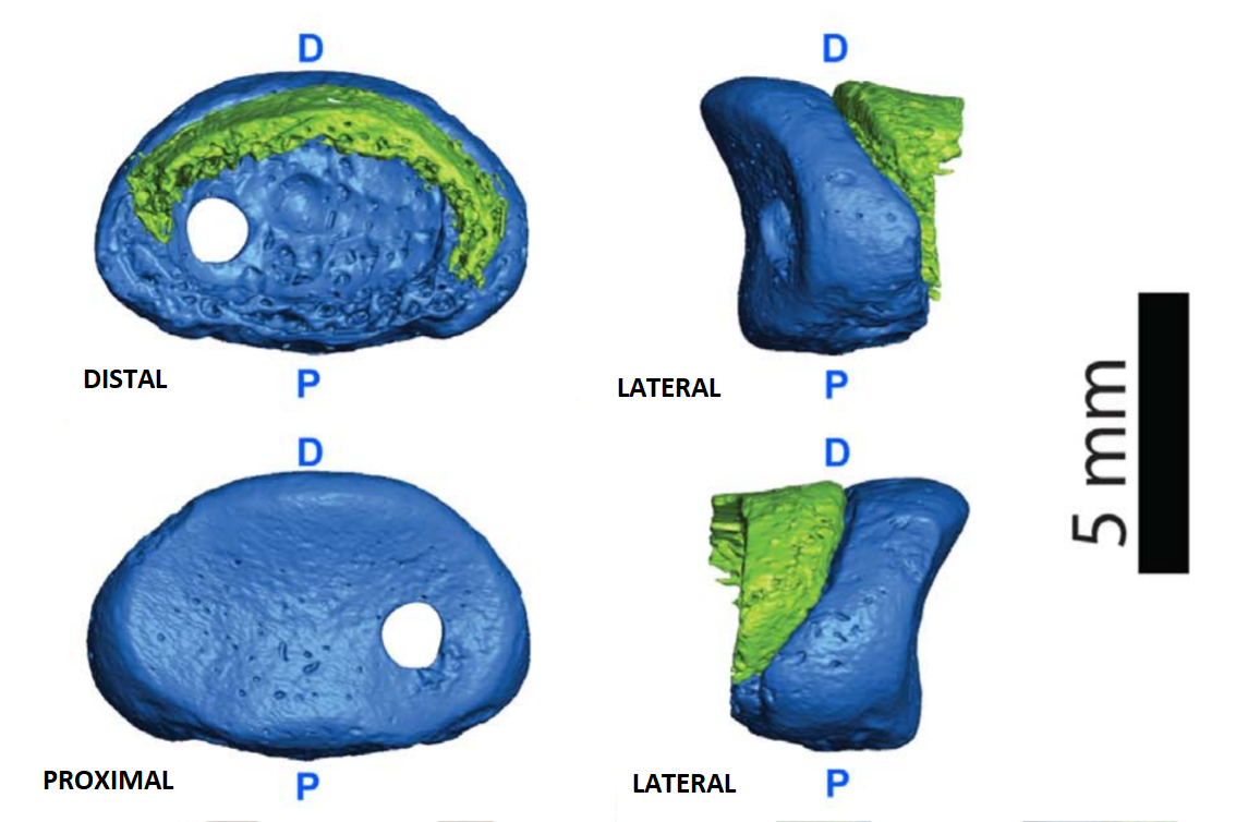 Denisovan fossil finger points to the timing of Neanderthal evolution ...