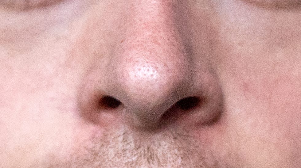 Here’s what happens when you leave marijuana up your nose for 18 years ...