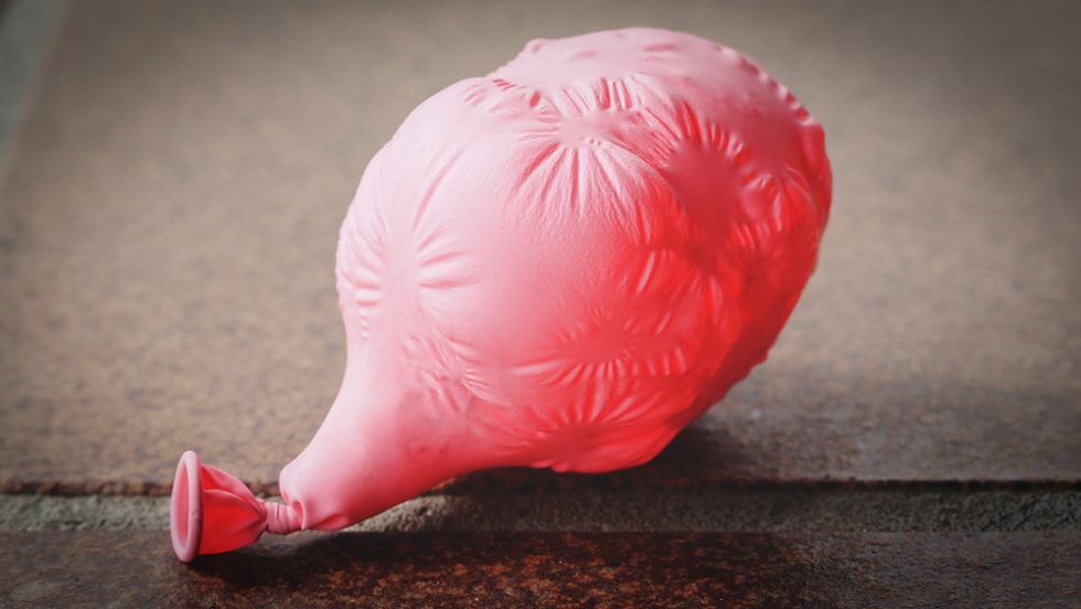 Man has massive, rotting scrotum removed after avoiding doctors for ...