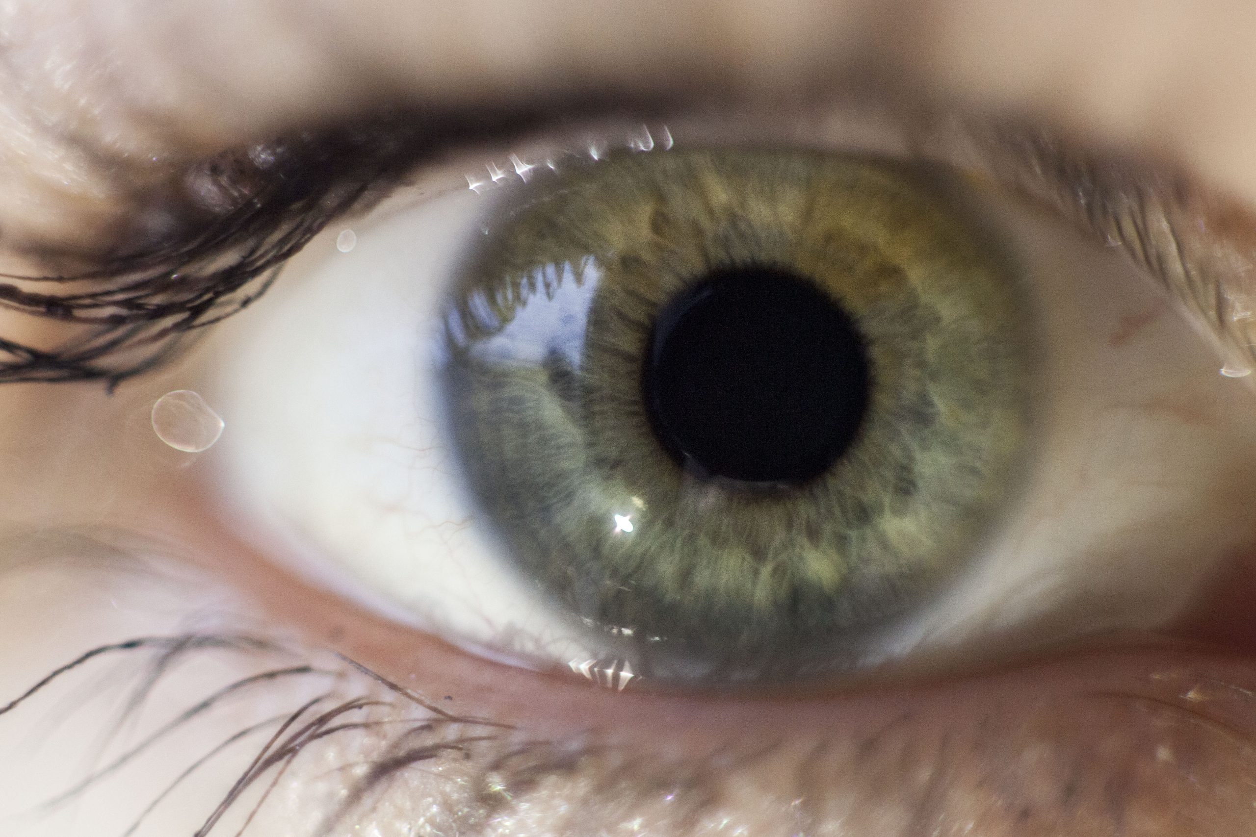 Cattle eyeball worms found in second human, raising worry of wriggly ...