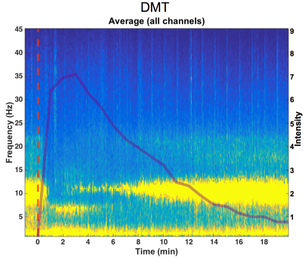 Ayahuasca alters brain waves to produce waking dream-like state, study ... Ayahuasca alters brain waves to produce waking dream-like state, study ...