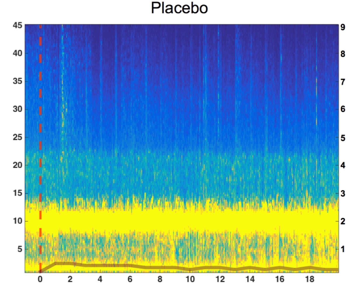 Ayahuasca alters brain waves to produce waking dream-like state, study ... Ayahuasca alters brain waves to produce waking dream-like state, study ...