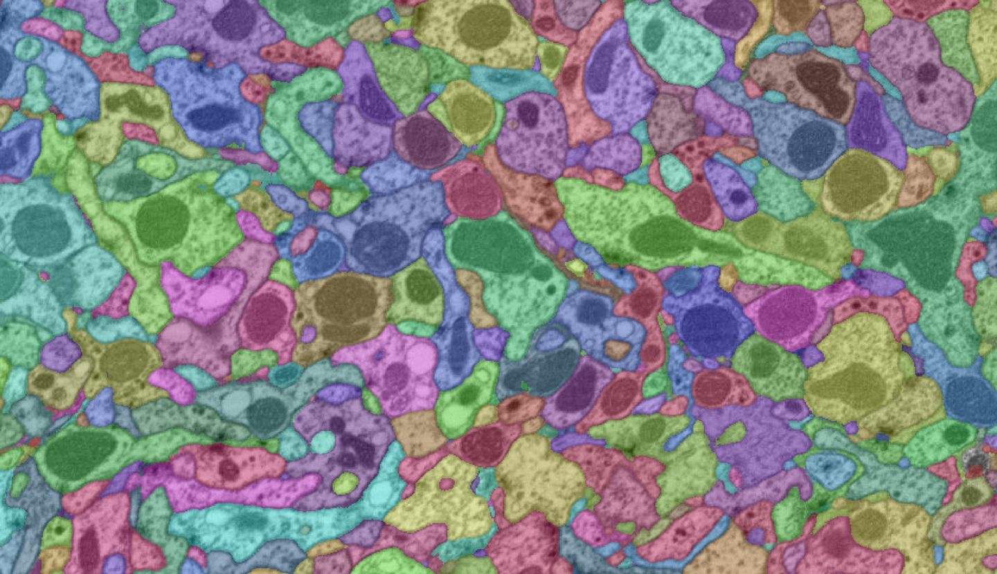 The most complete brain map ever is here: A fly’s “connectome” - Ars ...