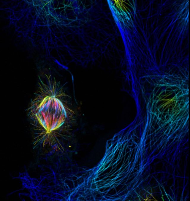 Extreme closeup of mouse-brain slice wins top Life Science Microscopy ...