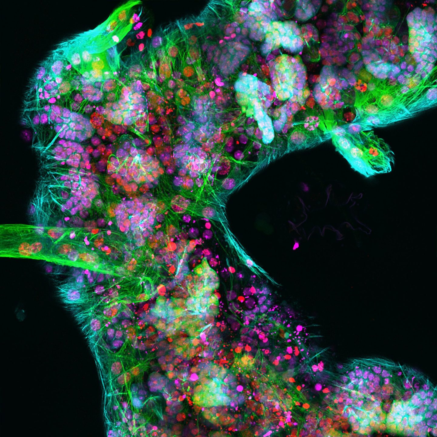 Extreme closeup of mouse-brain slice wins top Life Science Microscopy ...