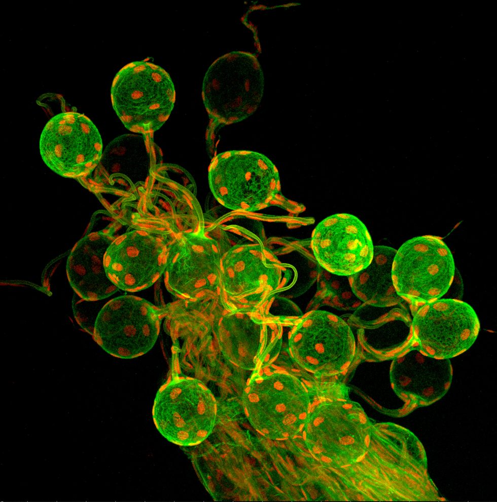 Extreme closeup of mouse-brain slice wins top Life Science Microscopy ...