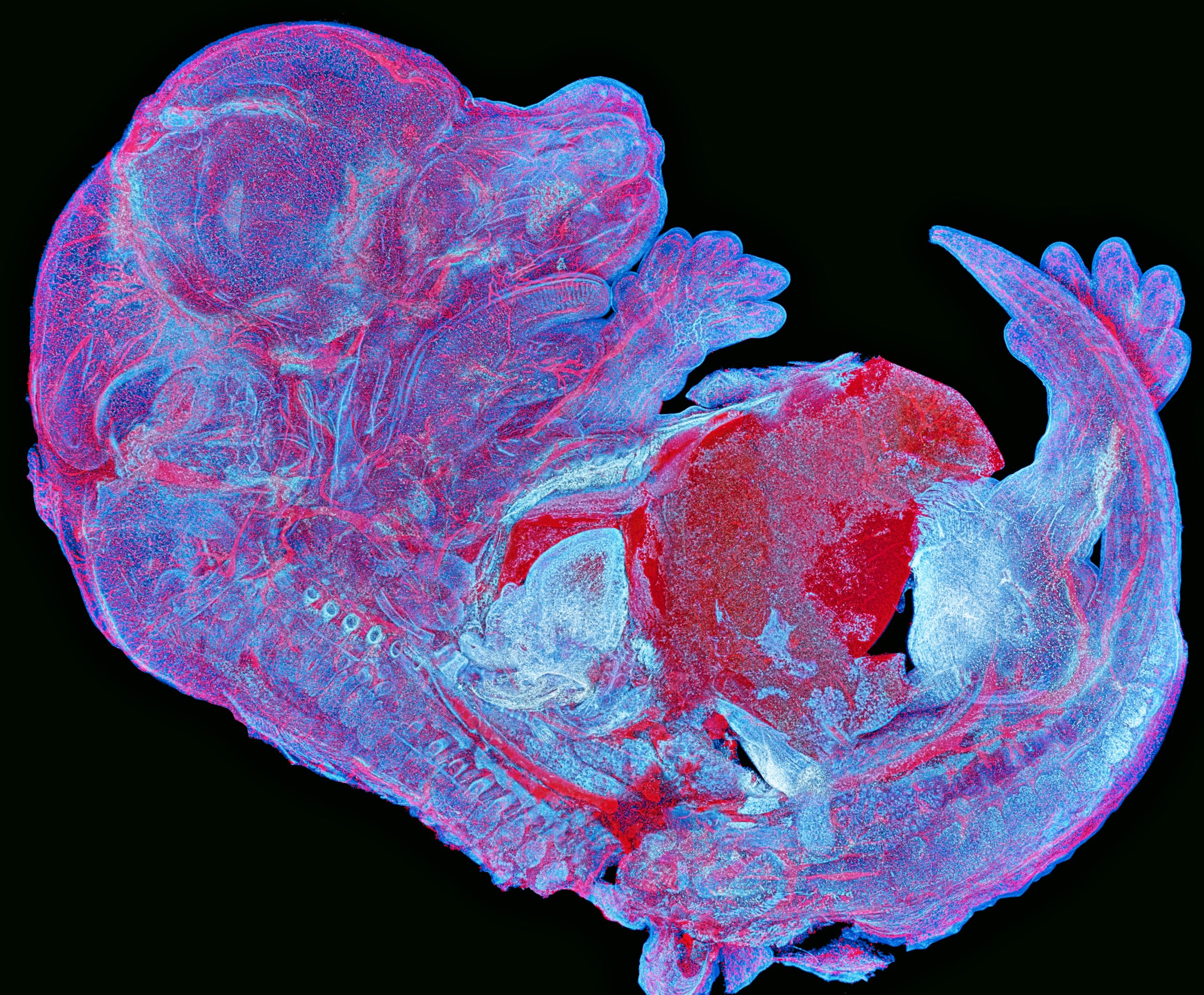 Extreme closeup of mouse-brain slice wins top Life Science Microscopy ...