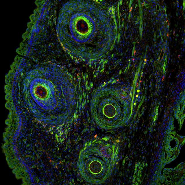 Extreme closeup of mouse-brain slice wins top Life Science Microscopy ...