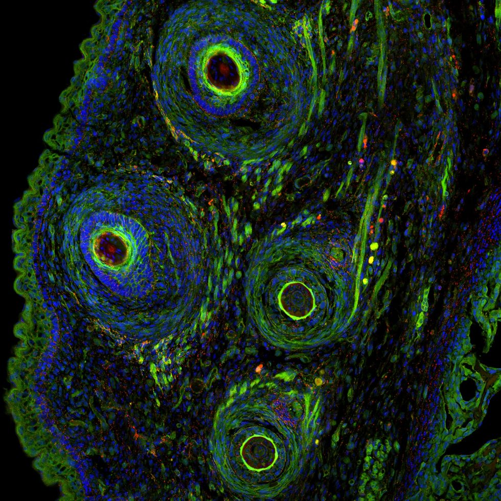Extreme closeup of mouse-brain slice wins top Life Science Microscopy ...