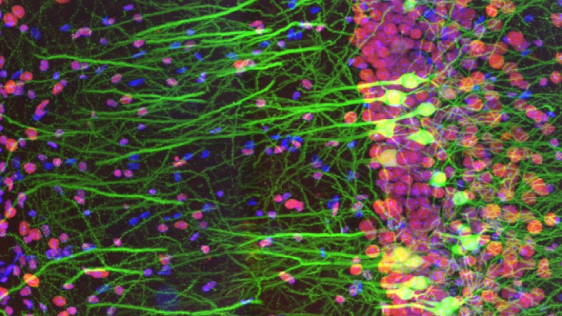 Extreme closeup of mouse-brain slice wins top Life Science Microscopy ...