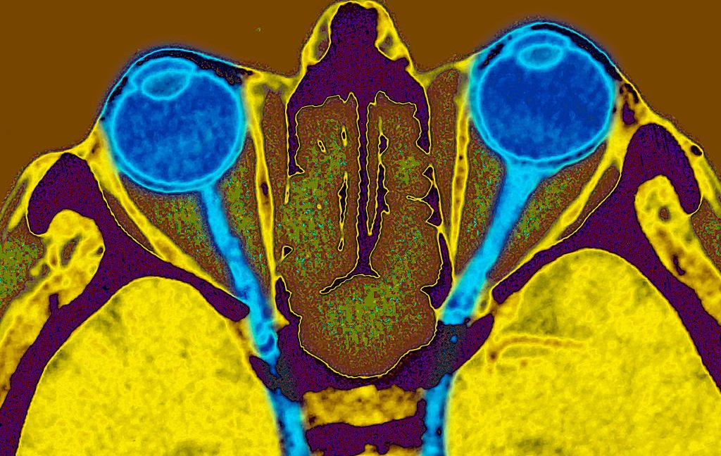 Two very different approaches to restoring vision - Ars Technica