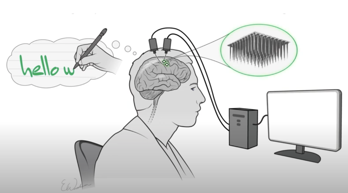 Neural implant lets paralyzed person type by imagining writing - Ars Technica