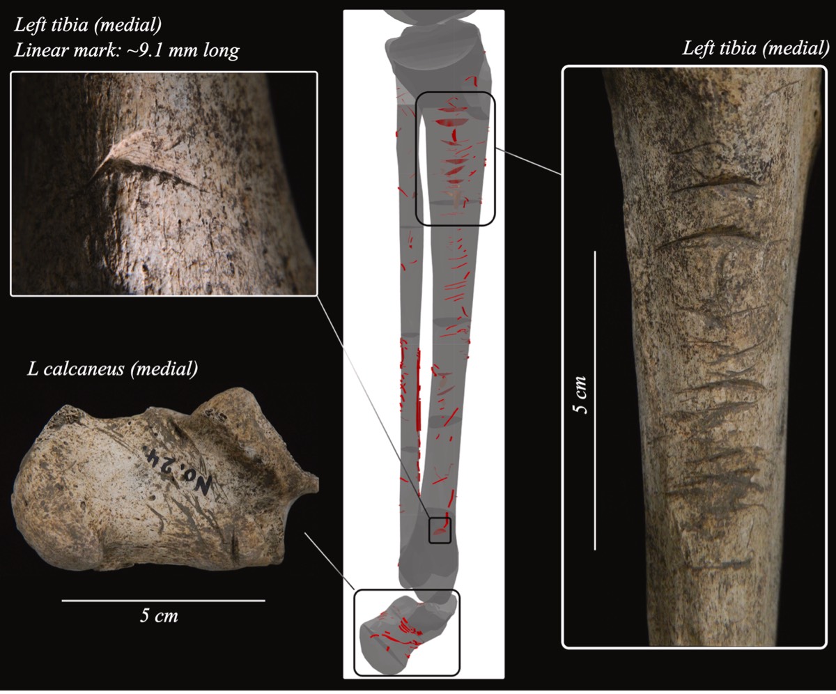 Cold-case files: Archaeologists discover 3,000-year-old victim of shark ...