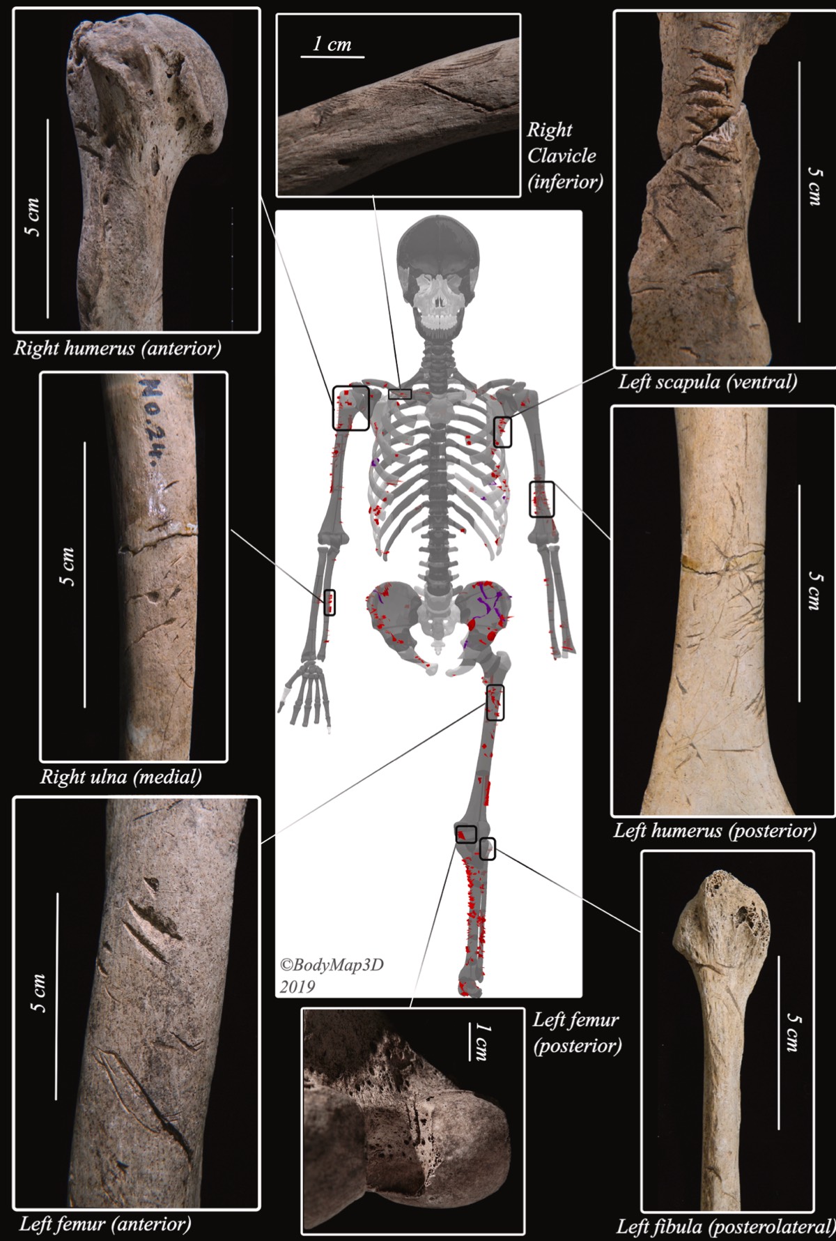 Cold-case files: Archaeologists discover 3,000-year-old victim of shark ...