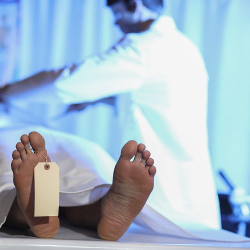 Tag: body parts - Ars Technica