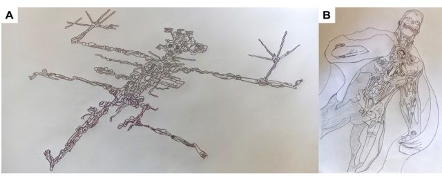 Could we build a synthetic digestive system for Vision to make him more ...