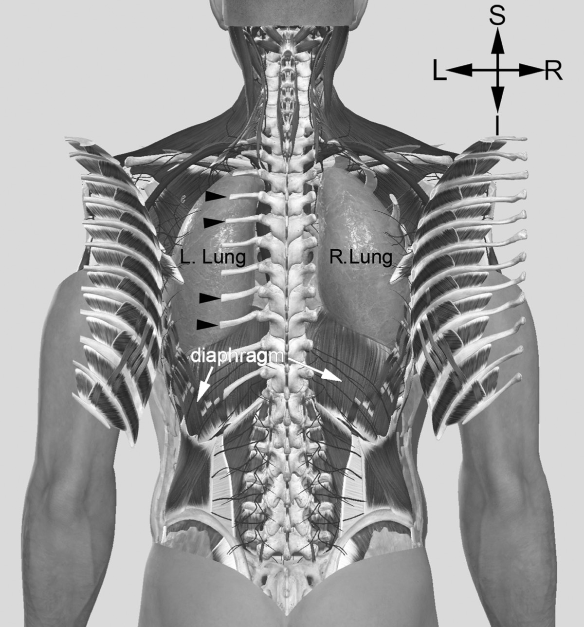 Gruesome Viking “blood eagle” ritual is anatomically possible, study ...