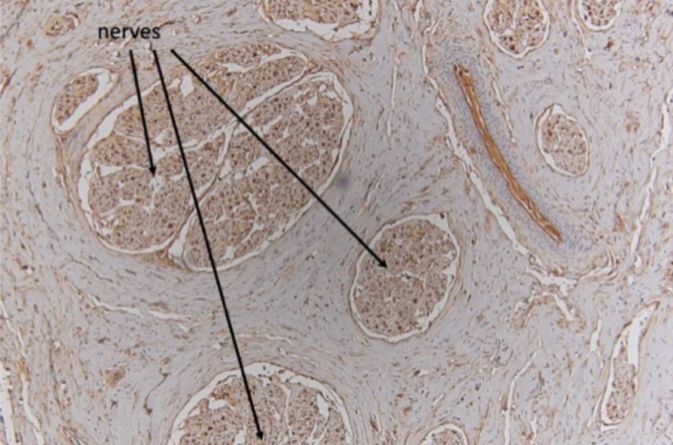 Study: Female dolphins have a working clitoris, so they probably enjoy ...