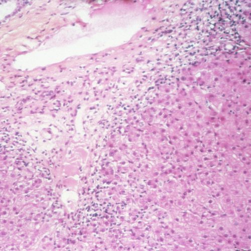 Tag: HLA - Ars Technica