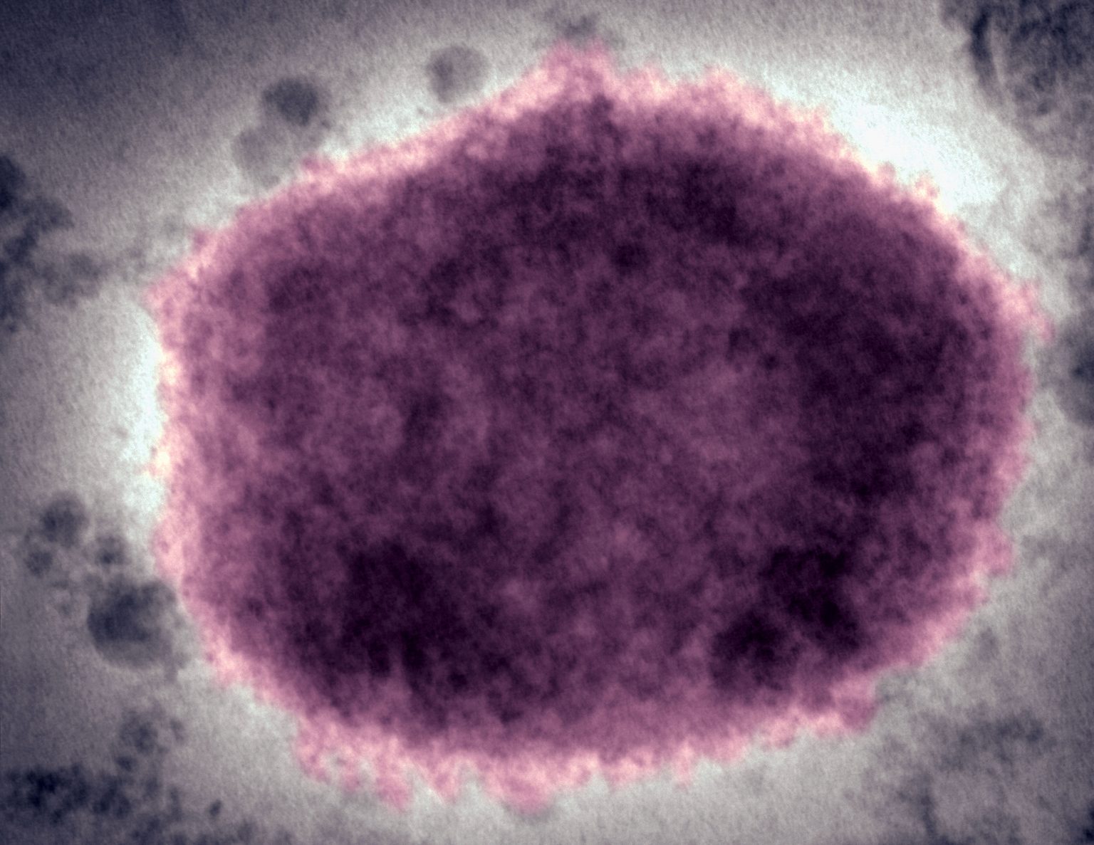 Mpox outbreak is an international health emergency, WHO declares - Ars ...