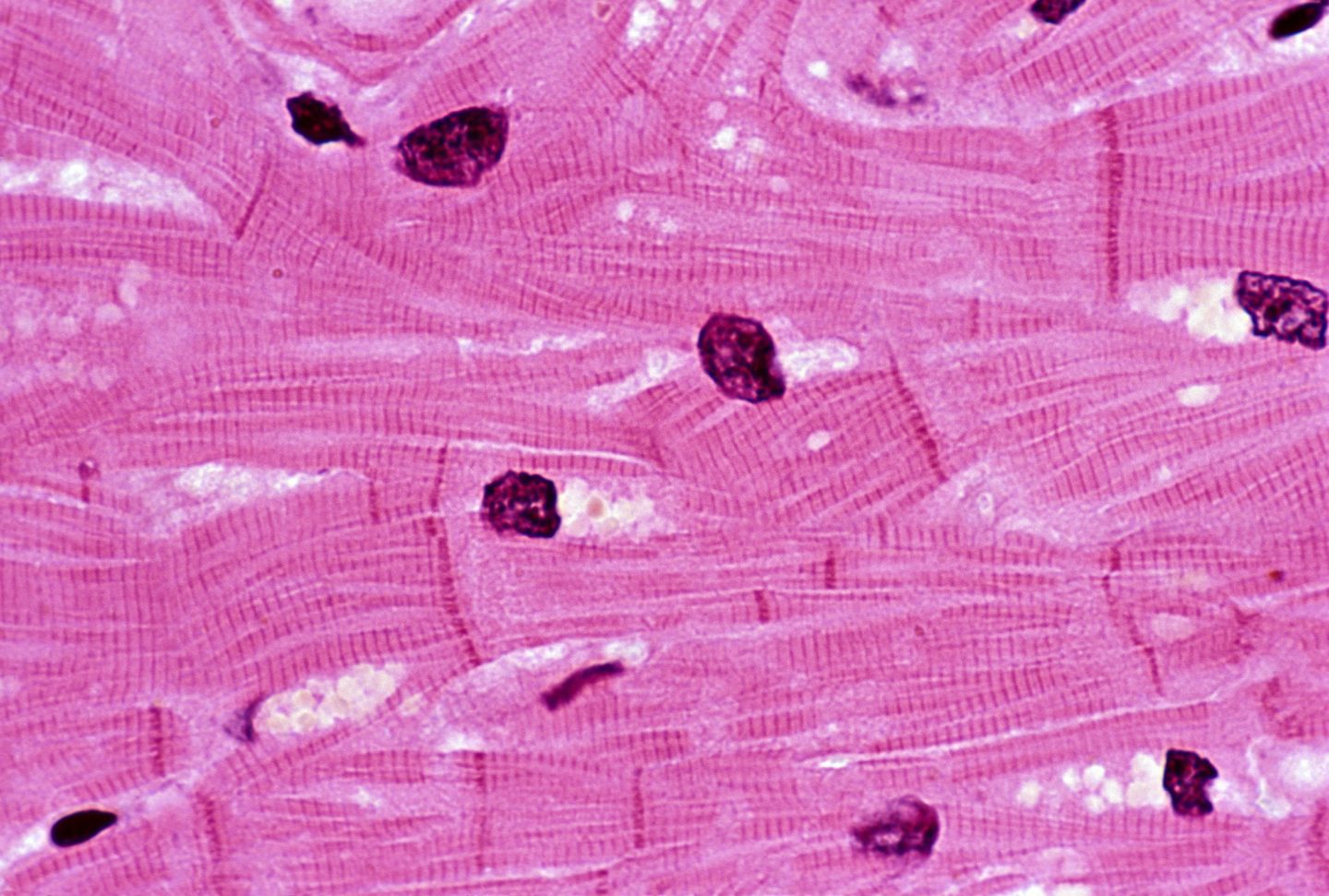 Pig heart transplant failure: Doctors detail everything that went wrong ...