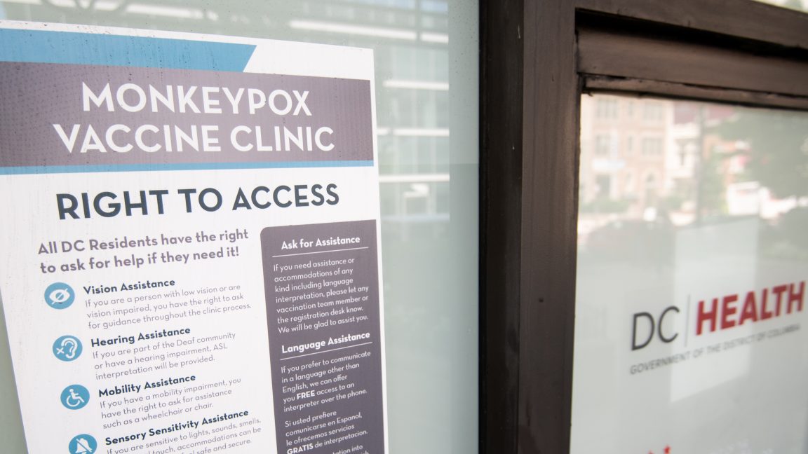 Everything you need to know about the monkeypox health emergency - Ars ...