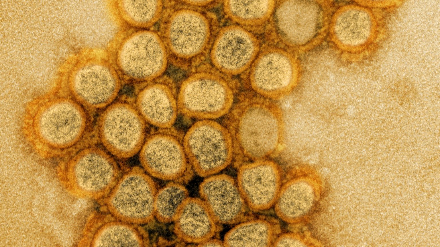 New COVID variant swiftly gains ground in US; concern looms for summer ...