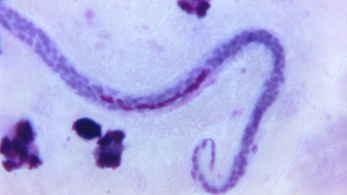 Twirling parasitic worms throw dance party in man’s scrotum - Ars Technica