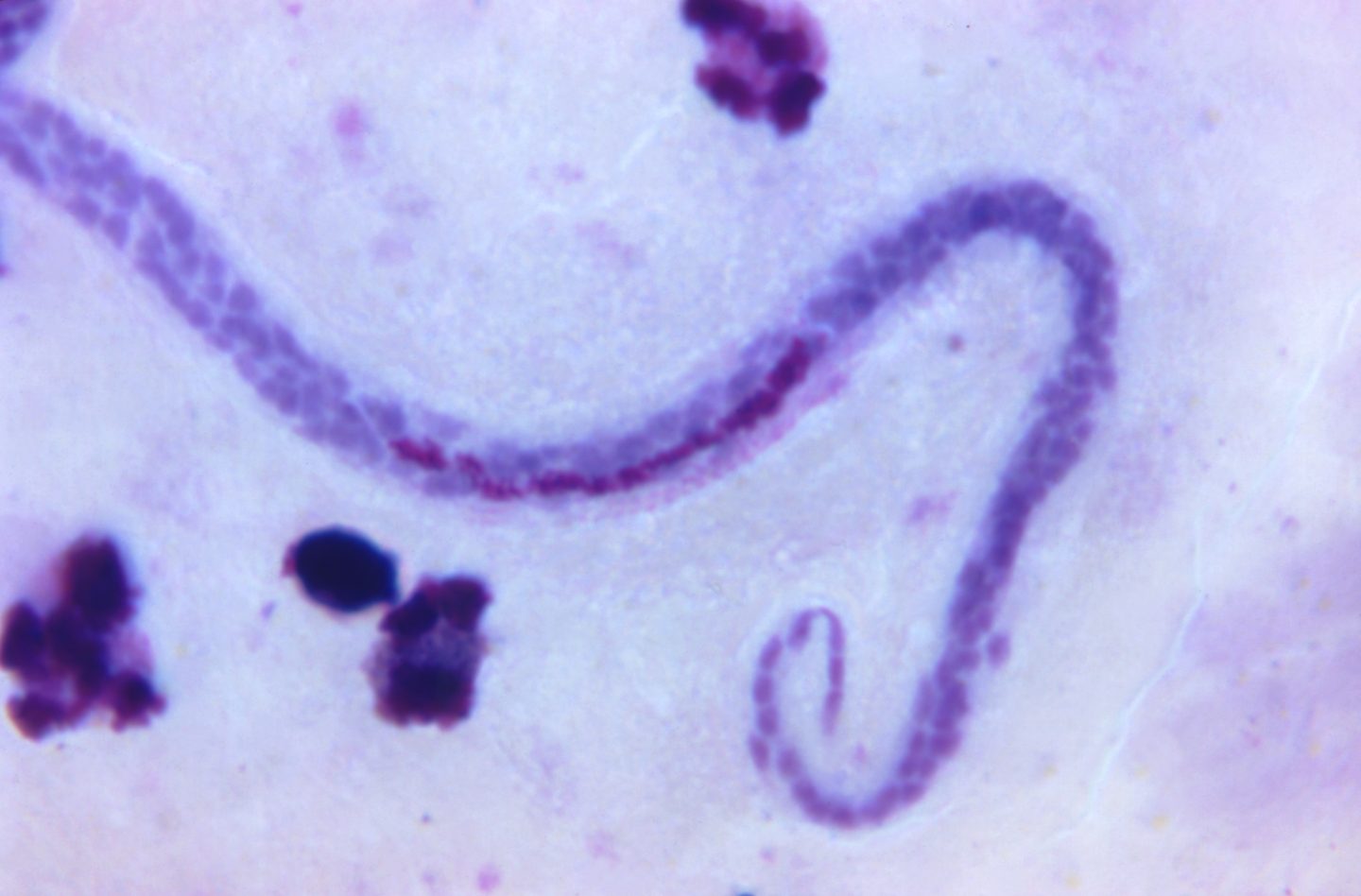 Twirling parasitic worms throw dance party in man’s scrotum - Ars Technica