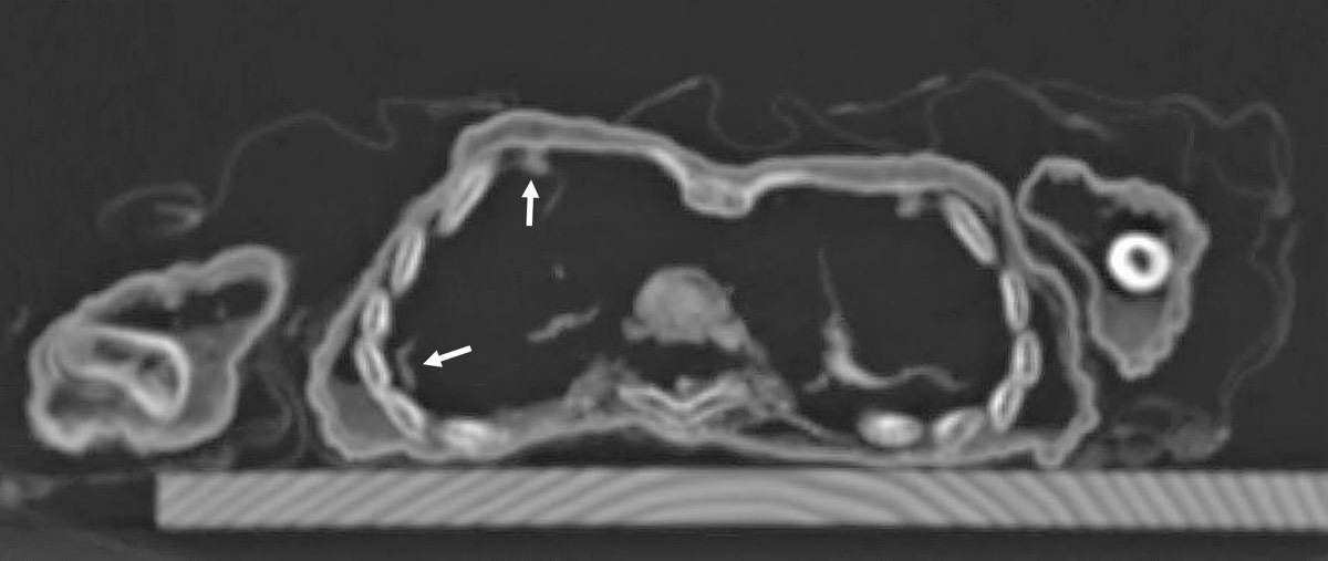 Tale from the crypt: Researchers conduct “virtual autopsy” of mummified ...