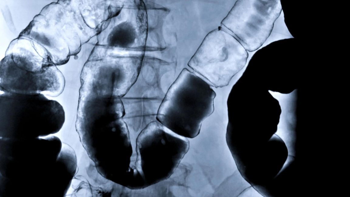 Scientists grew mini human guts inside mice - Ars Technica