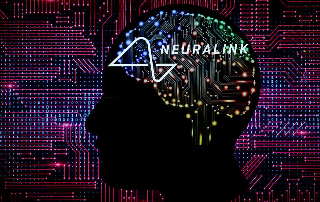 Neuralink says it has the FDA’s OK to start clinical trials - Ars Technica