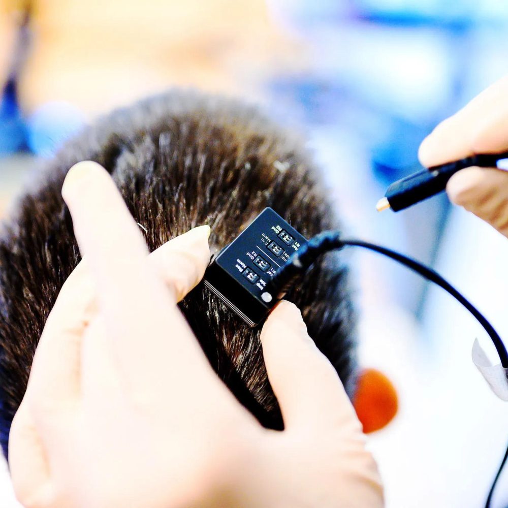 Tag: brain implants - Ars Technica