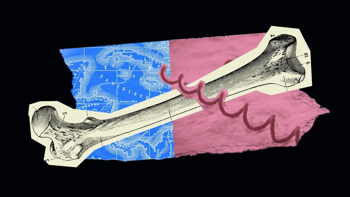 The history of syphilis is being rewritten by a medieval skeleton - Ars ...