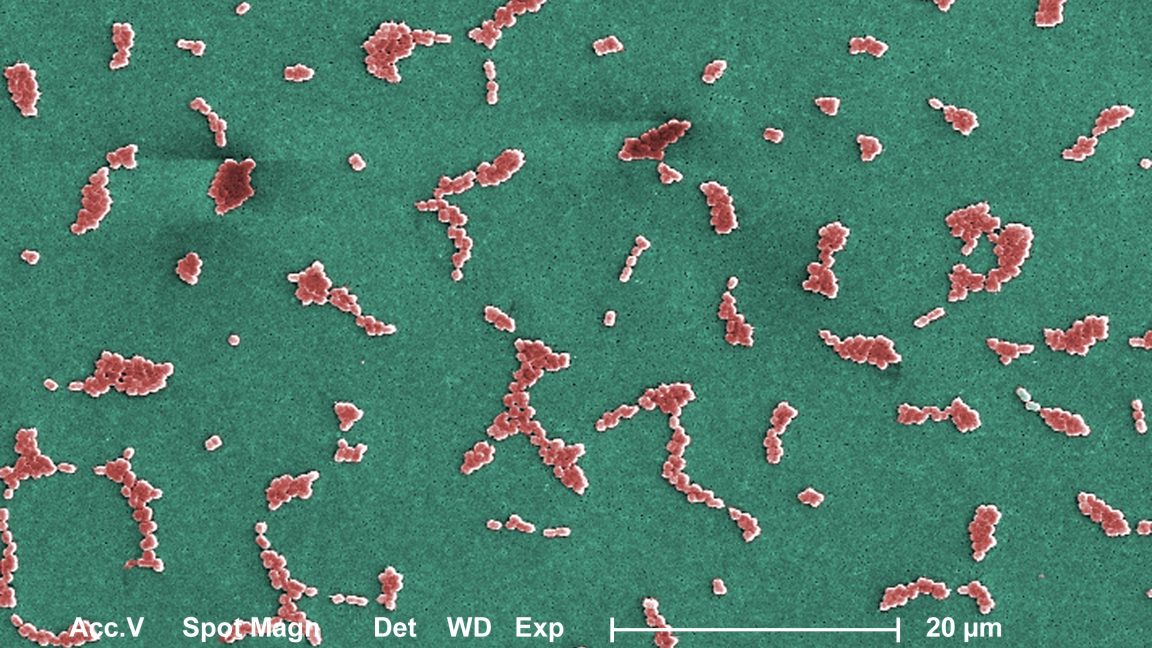 Experimental antibiotic kills deadly superbug, opens whole new class of ...