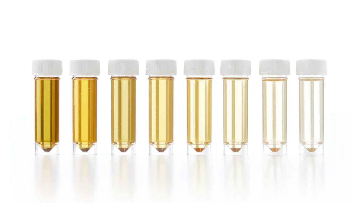Gotta go? We’ve finally found out what makes urine yellow - Ars Technica