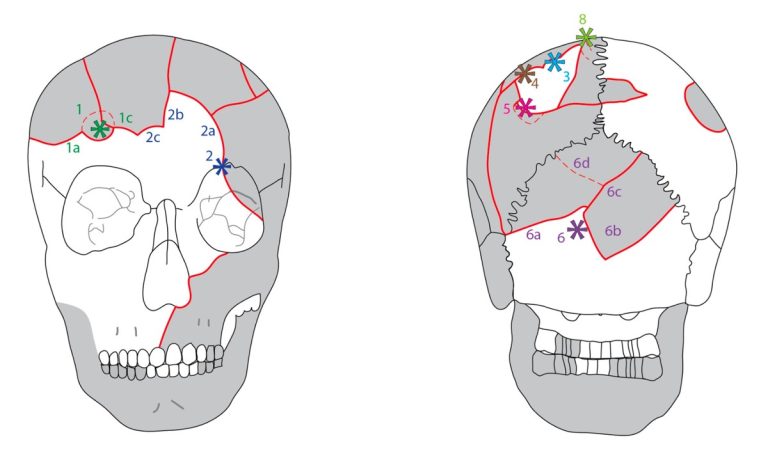 Brutally bludgeoned “Vittrup Man” went from forager to farmer before ...