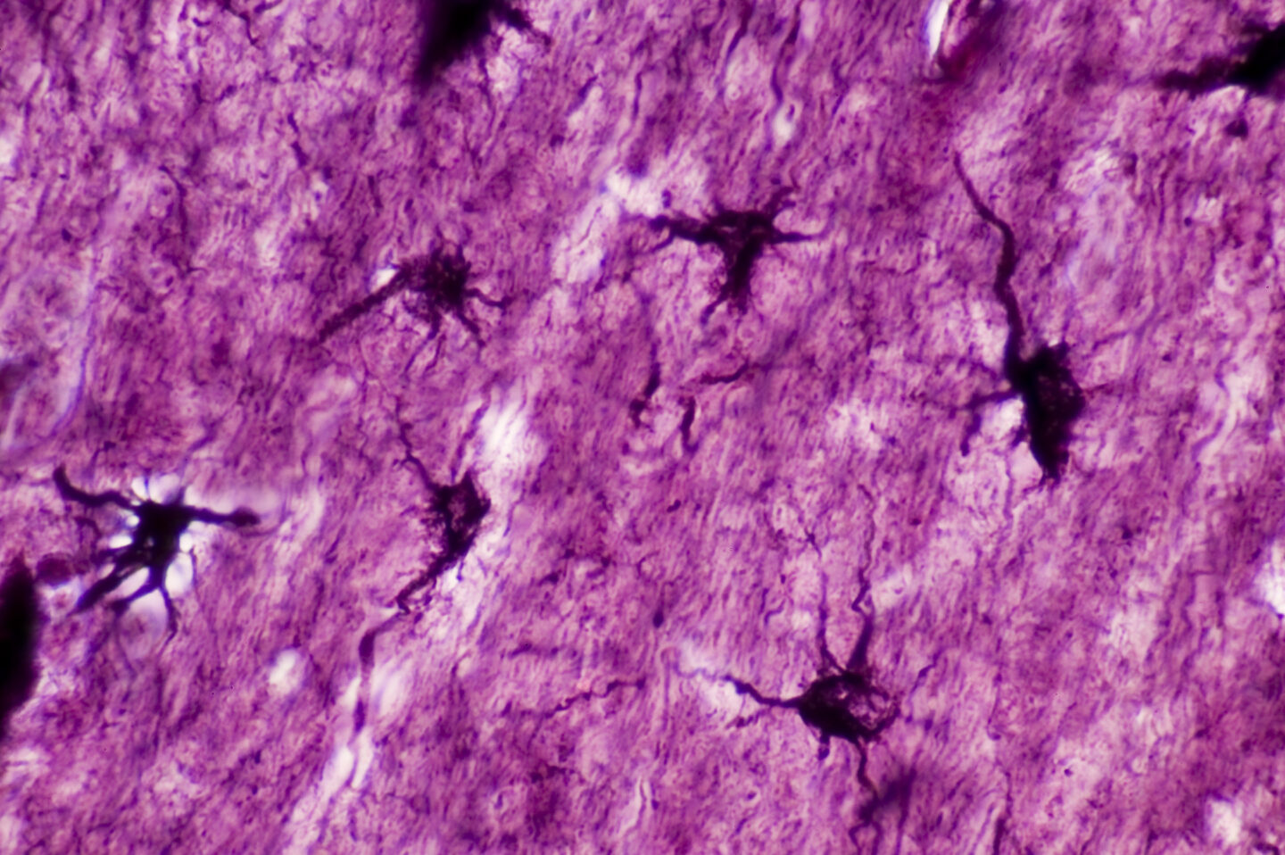 Astrocytes play a key role in memory - Ars Technica