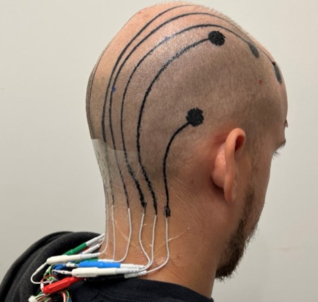 E-tattoos could make mobile EEGs a reality - Ars Technica