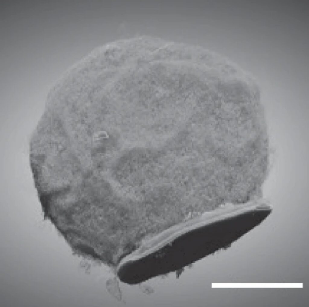 Tiny chips hitch a ride on immune cells to sites of inflammation - Ars ...
