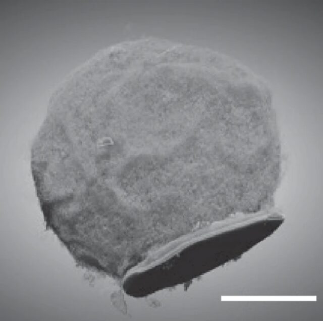 Tiny chips hitch a ride on immune cells to sites of inflammation - Ars ...
