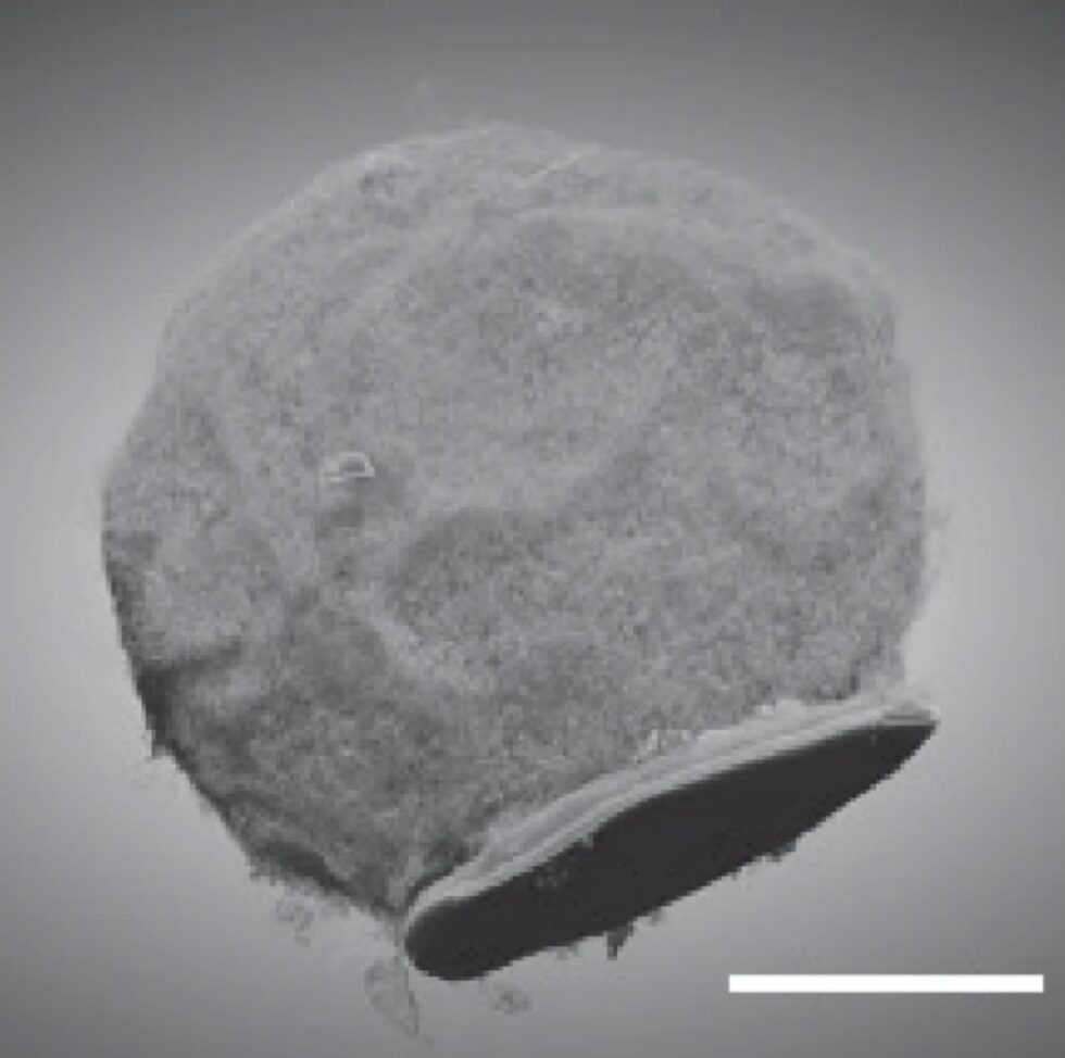Tiny chips hitch a ride on immune cells to sites of inflammation - Ars ...