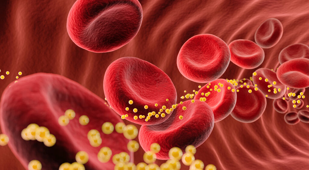 Bad cholesterol slashed 62% by single dose of gene-editing drug in ...