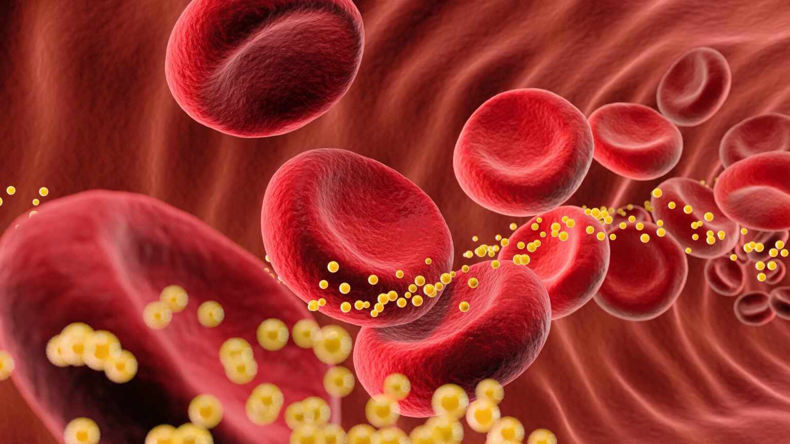 One dose of gene-editing drug cut bad cholesterol 62% for months in ...