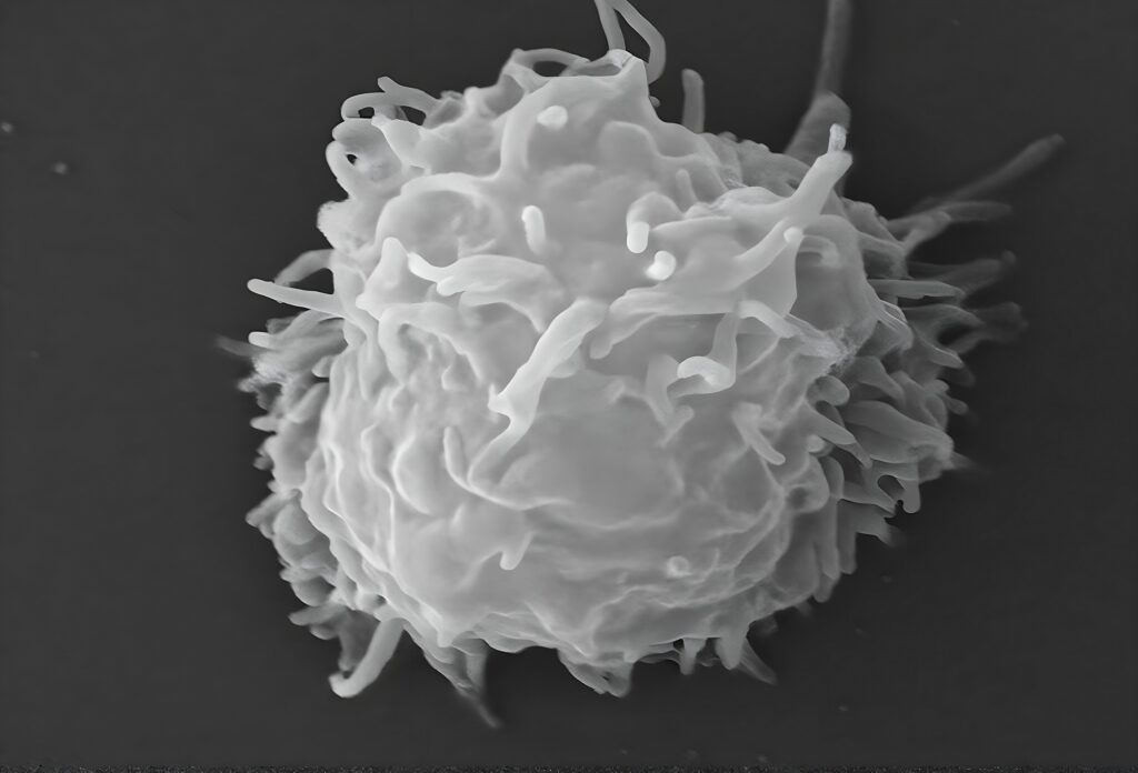 Man dies covered in necrotic lesions after amoebas eat him alive - Ars ...