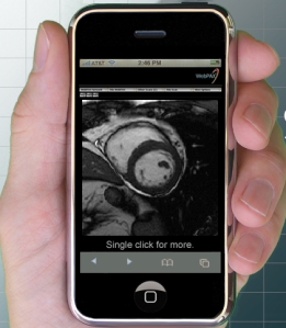 The iPhone has a heart… for doctors, that is - Ars Technica